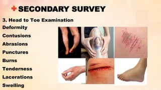 First Aid Lesson.pptx