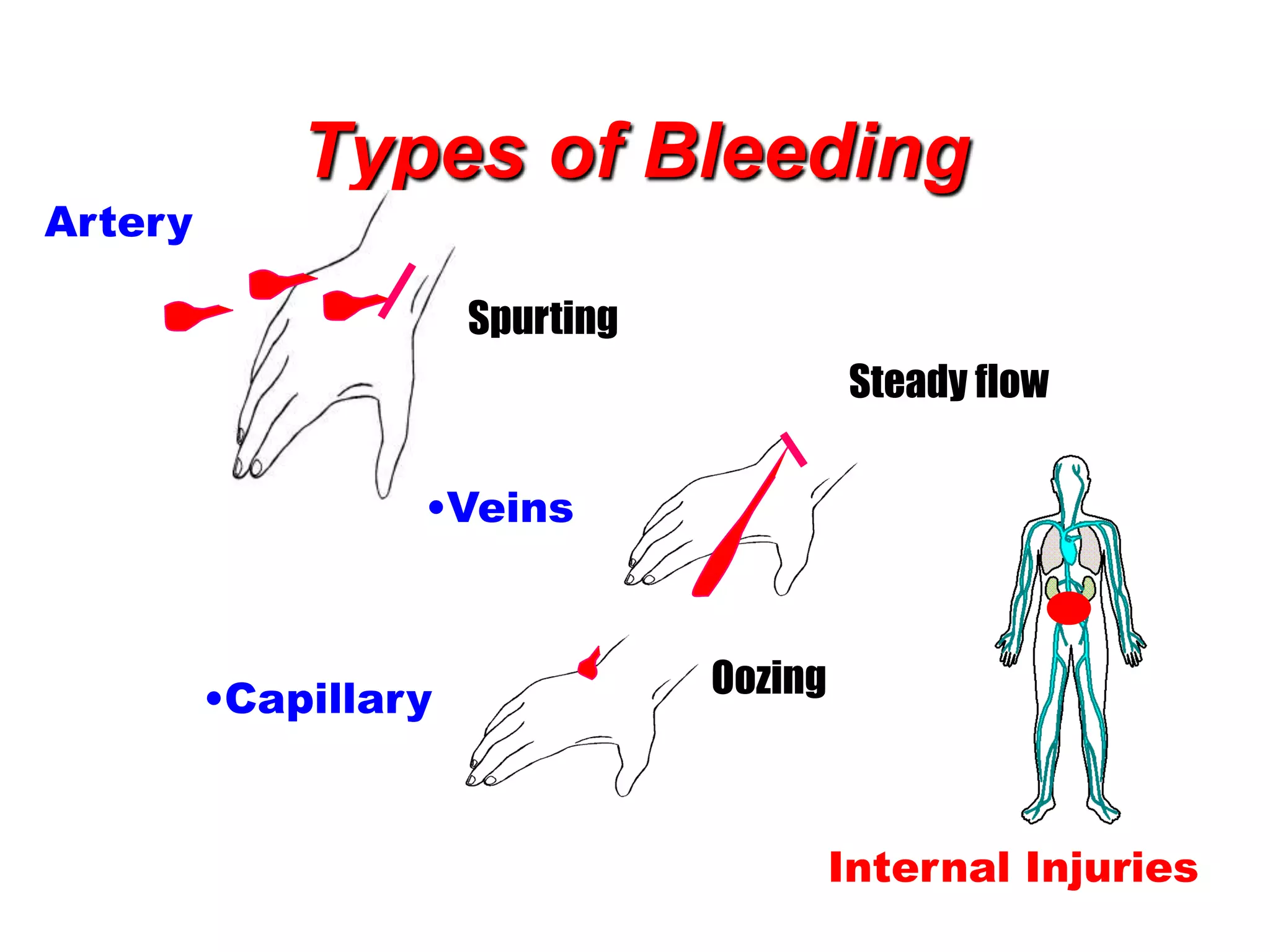 First aid lesson carrying | PPTX