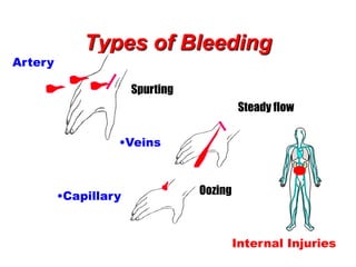 First aid lesson carrying | PPTX