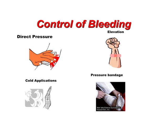 First aid lesson carrying | PPTX