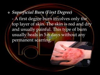 First aid management | PPT