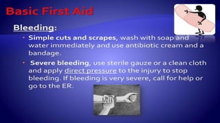 First aid for burns, fractures, wounds, frostbites, solar, heat, sun ...