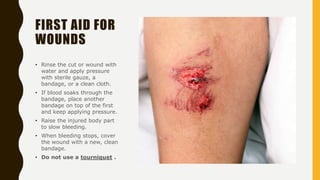 First aid for burns, fractures, wounds, frostbites, solar, heat, sun ...