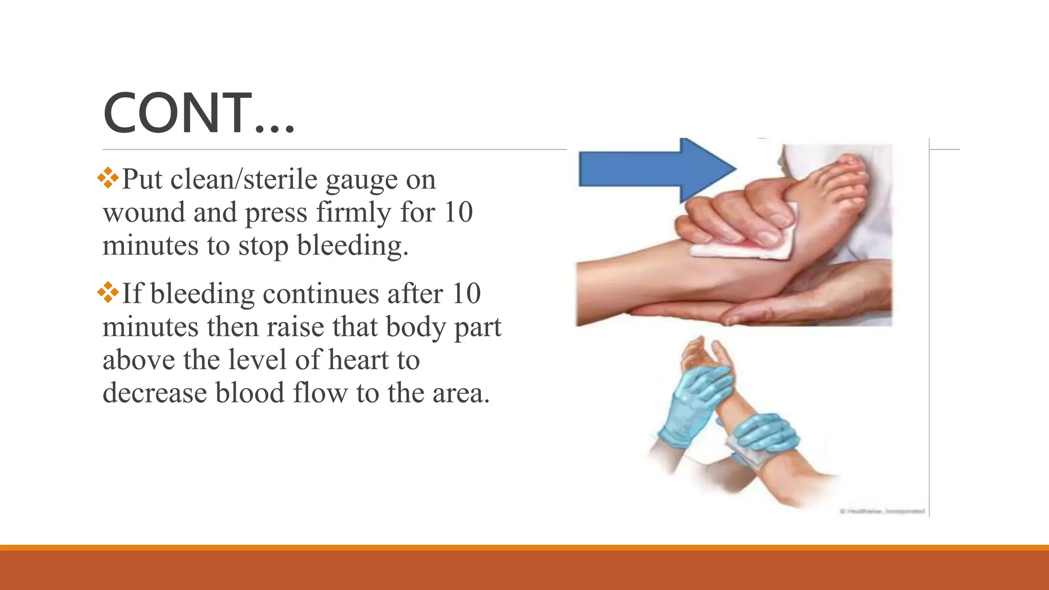 FIRST AID oF Hemmorhage: preparing for the immediate care | PPTX