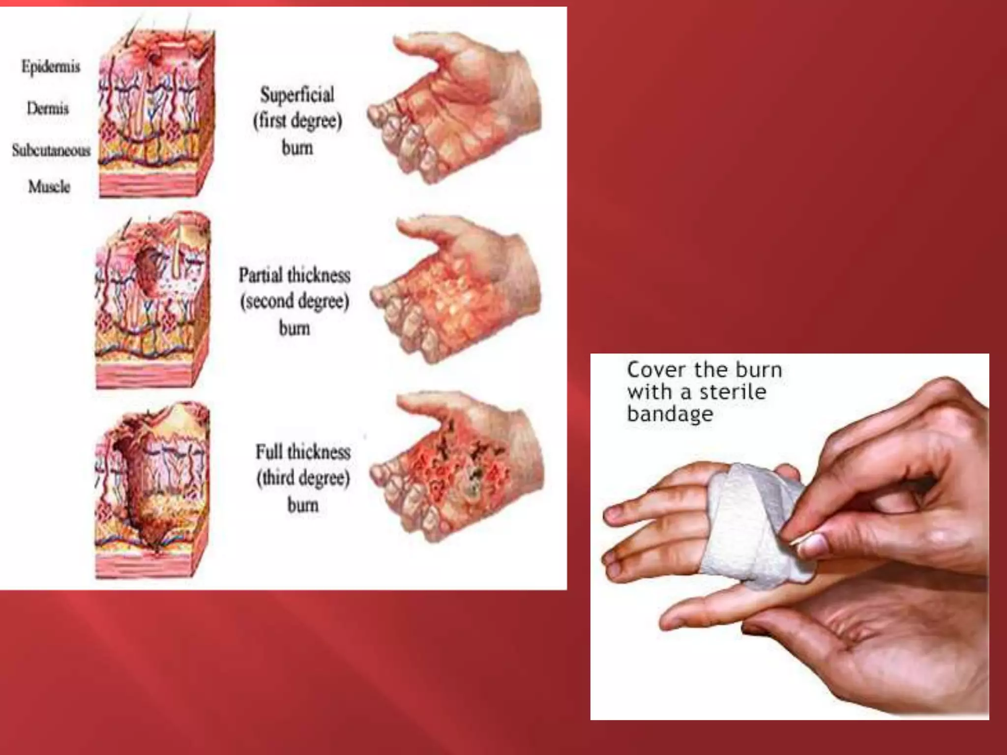 First aid ppt | PPTX