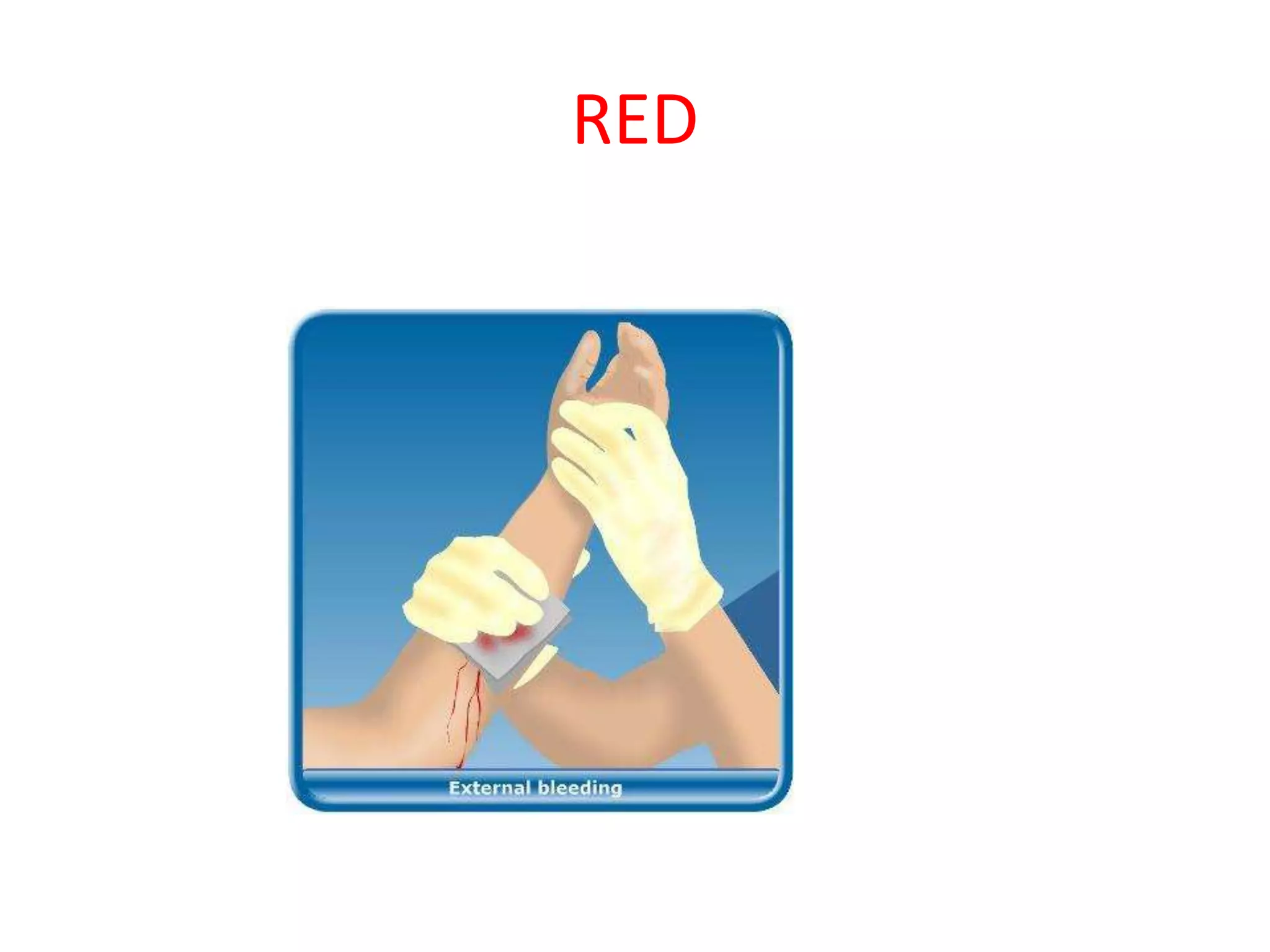 First aid ppt | PPTX | First Aid | Injuries