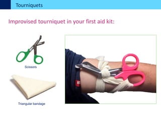 first aid PPT.pptx basic first aids ppts | PPT
