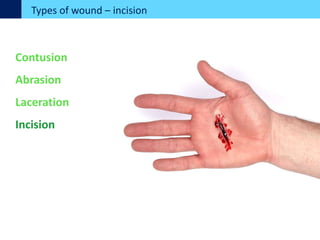 first aid PPT.pptx basic first aids ppts | PPT