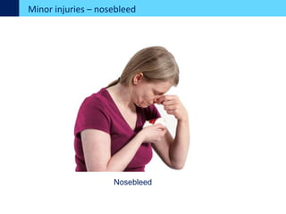 first aid PPT.pptx basic first aids ppts | PPT