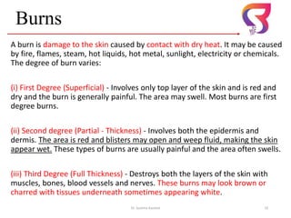 firstaidppt-Dr. Sushma.pptx