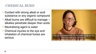 First Aid & Primary Management of Burns.pptx