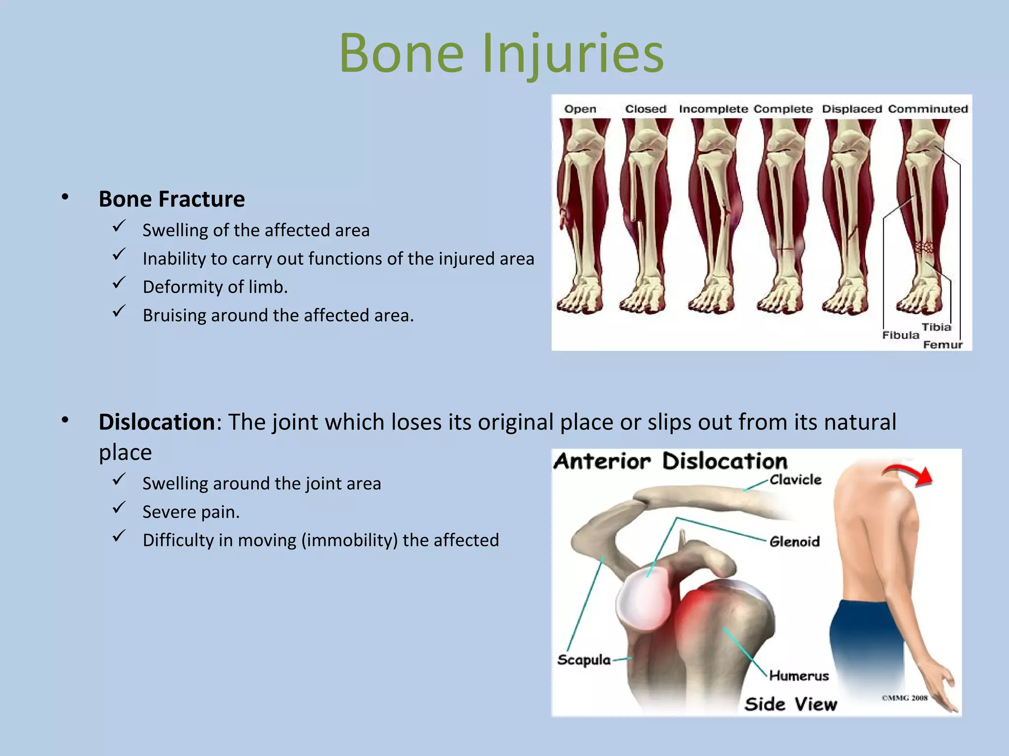 First Aid and Sport Injuries | PPT