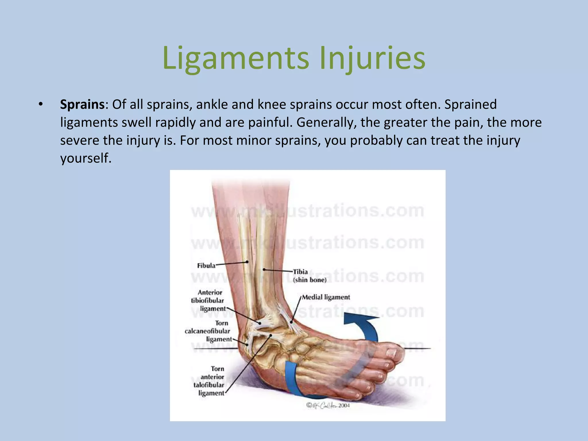 First Aid and Sport Injuries | PPT