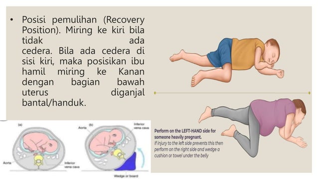 FIRST AID TERSEDAK DAN HENTI NAFAS & JANTUNG.pptx