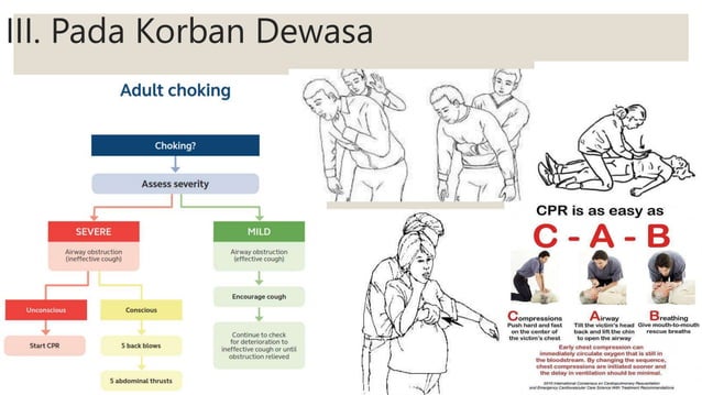 FIRST AID TERSEDAK DAN HENTI NAFAS & JANTUNG.pptx