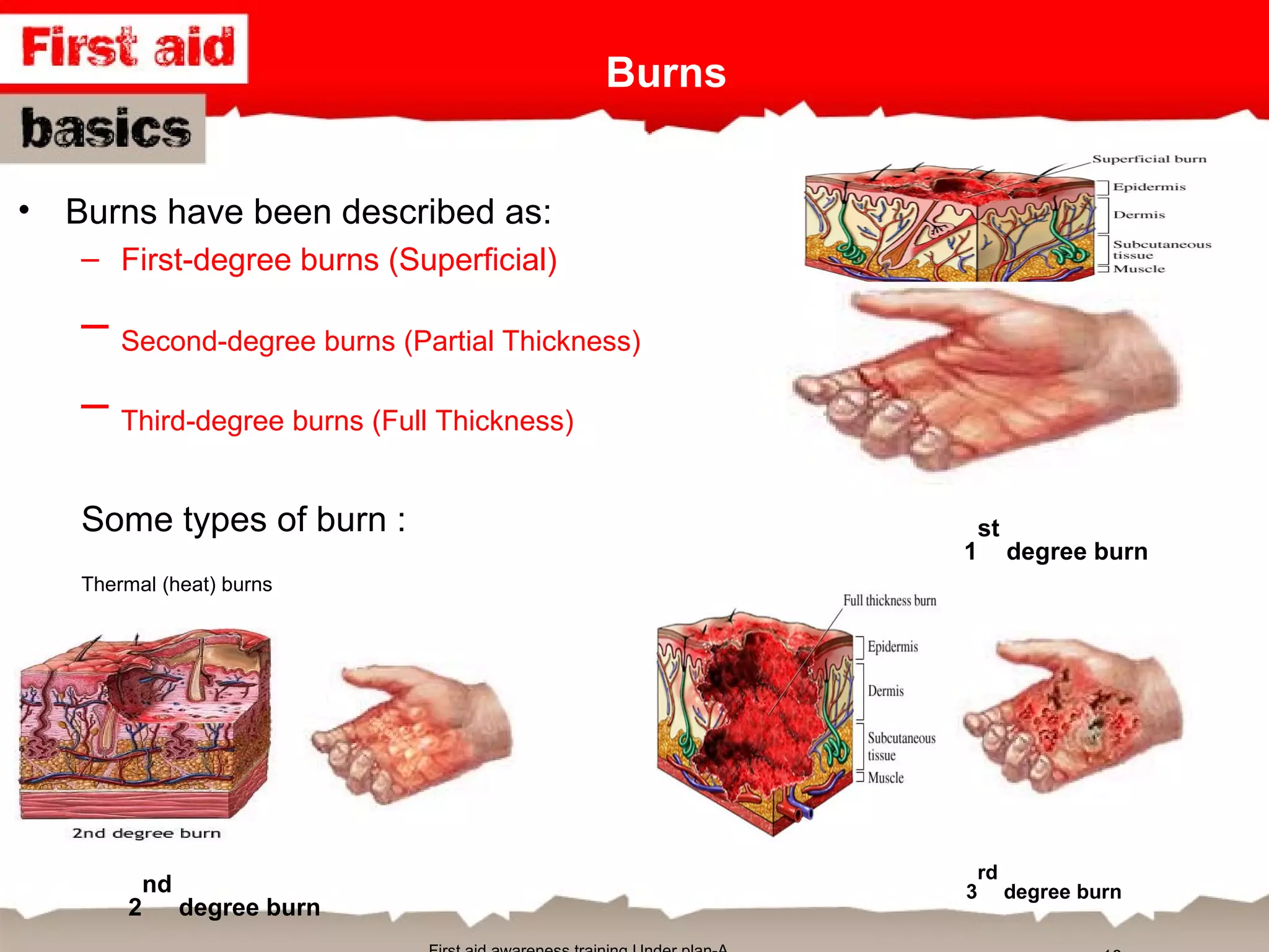 First Aid Training | PPT