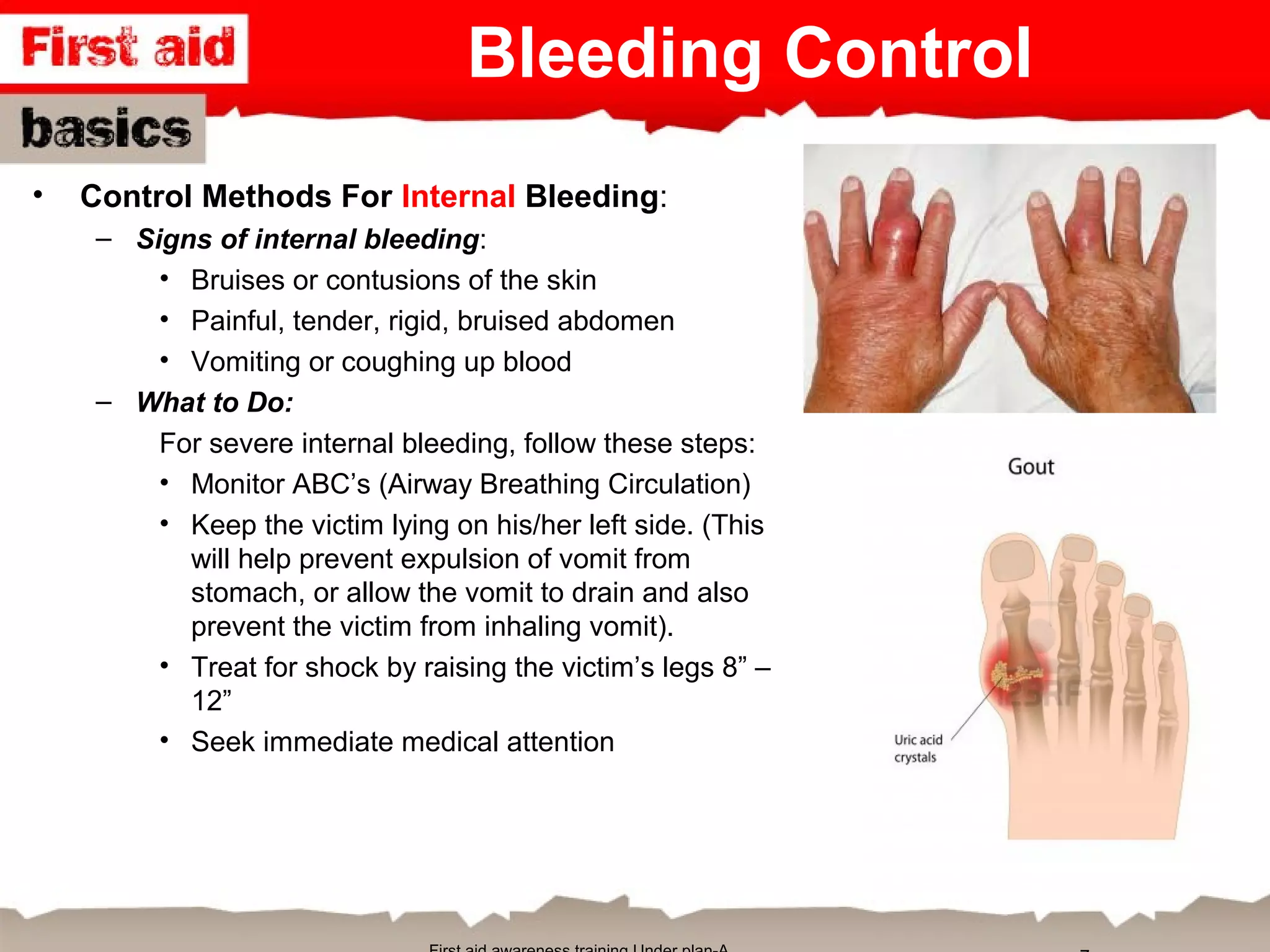 First Aid Training | PPT