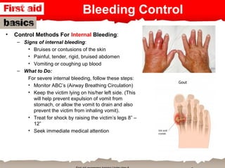 First Aid Training | PPT | First Aid | Injuries