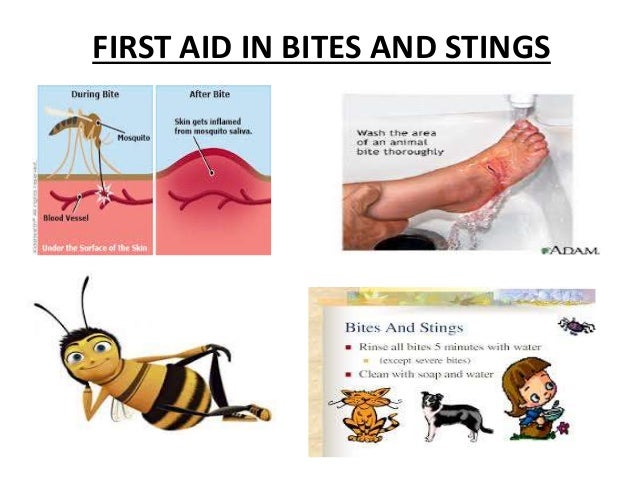 First aid training @ work place by Dr.Vivek Gopal BHMS,NDH(NZ),PGDHA