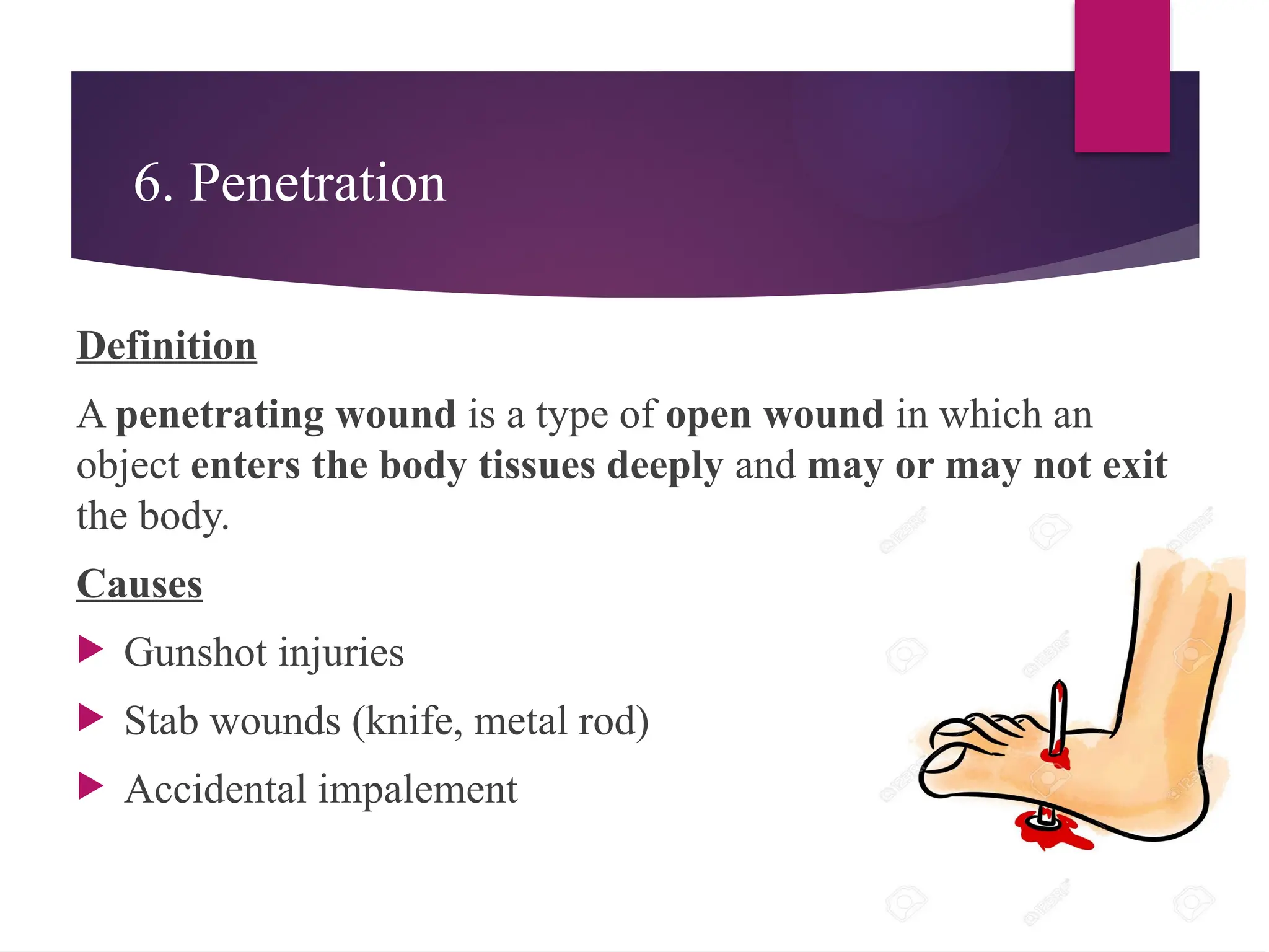 CUTS AND WOUNDS PPT ...... First Aid Management | PPTX