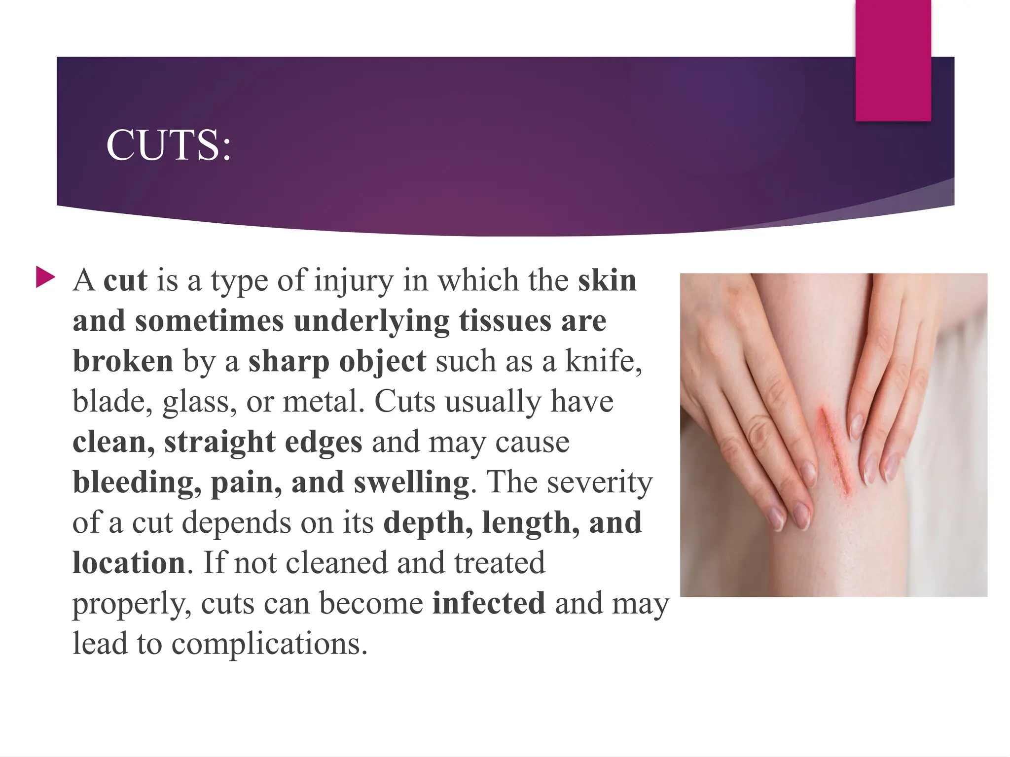CUTS AND WOUNDS PPT ...... First Aid Management | PPTX