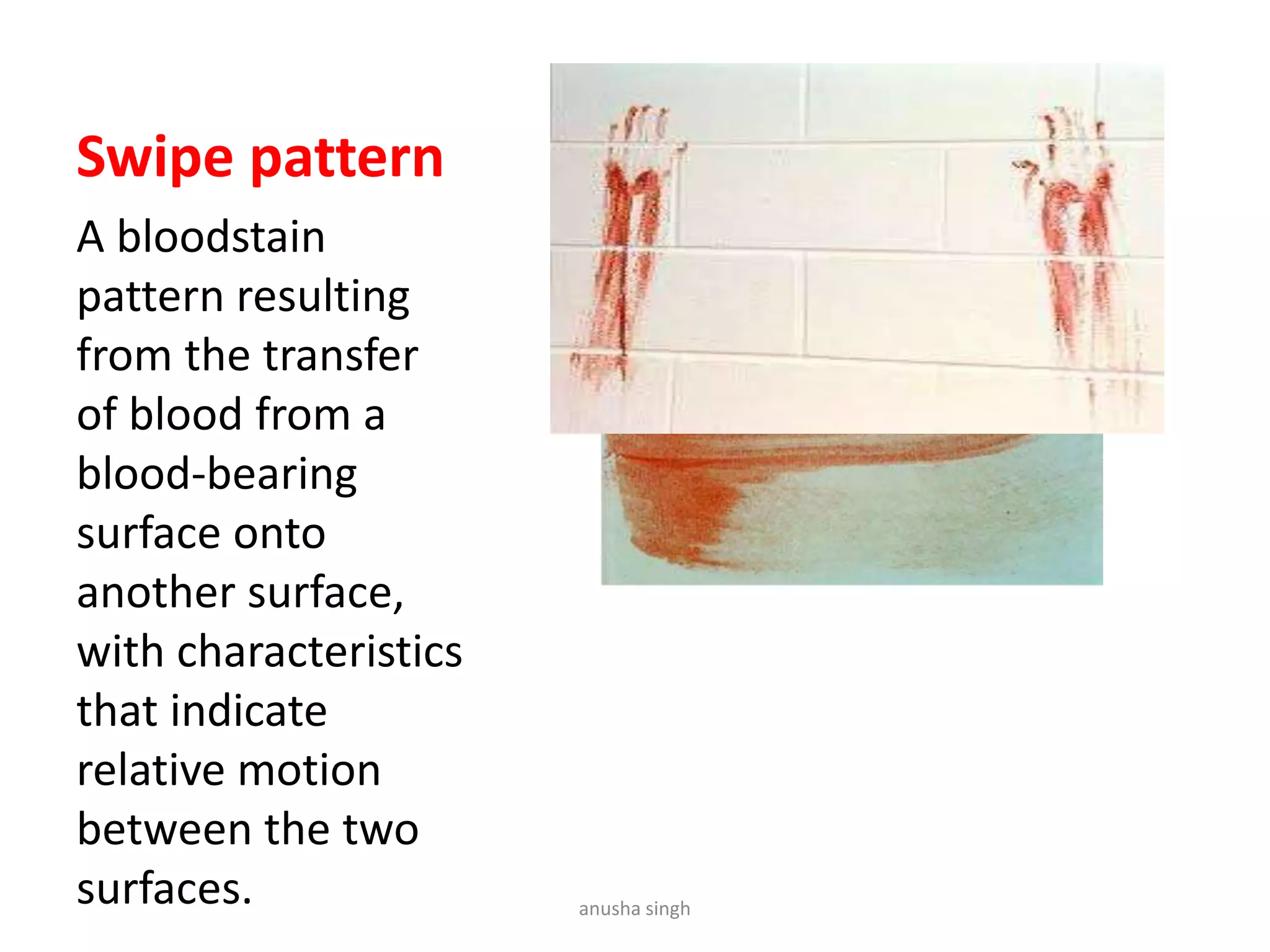 blood spatter analysis | PPT