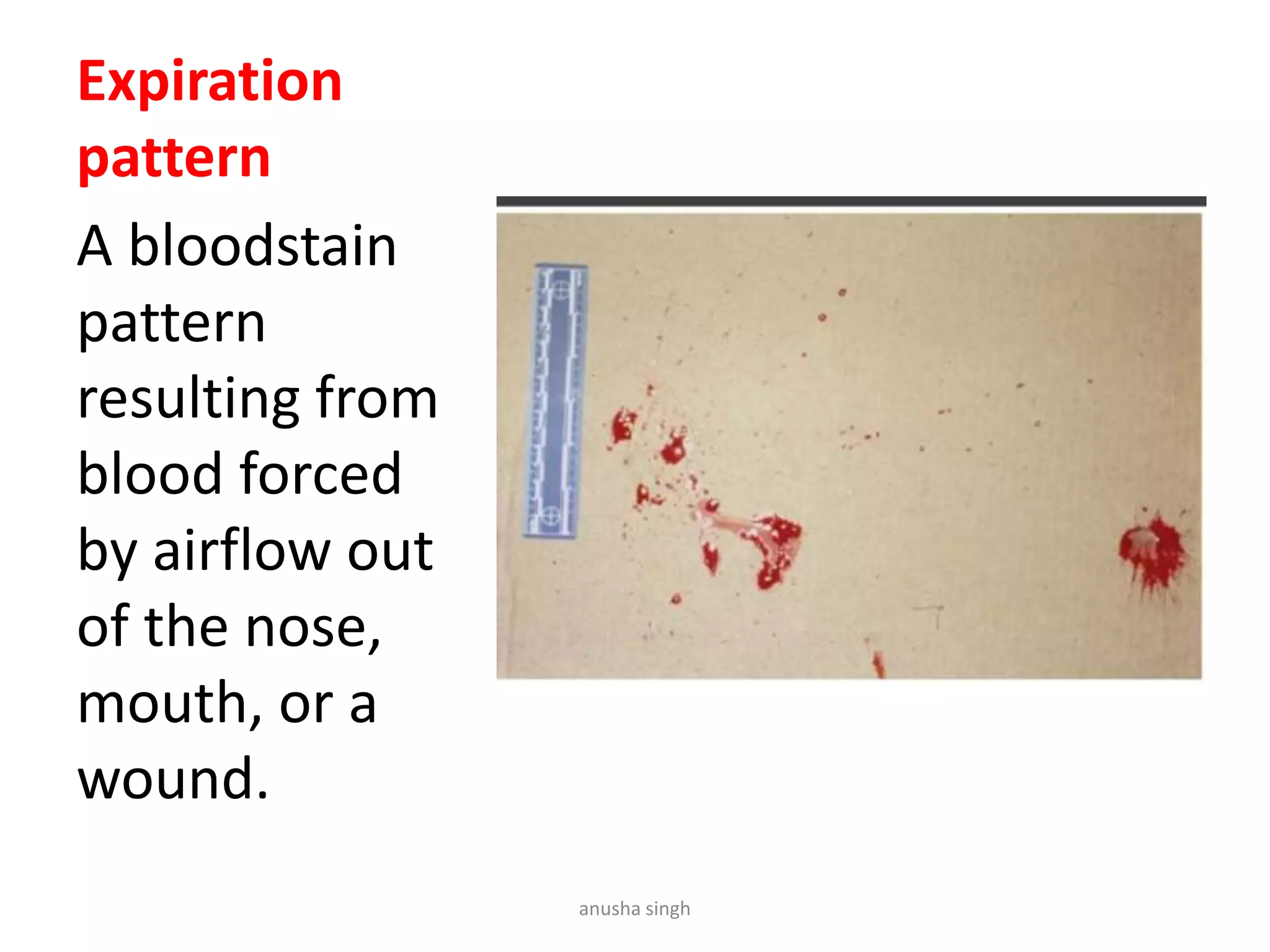blood spatter analysis | PPT