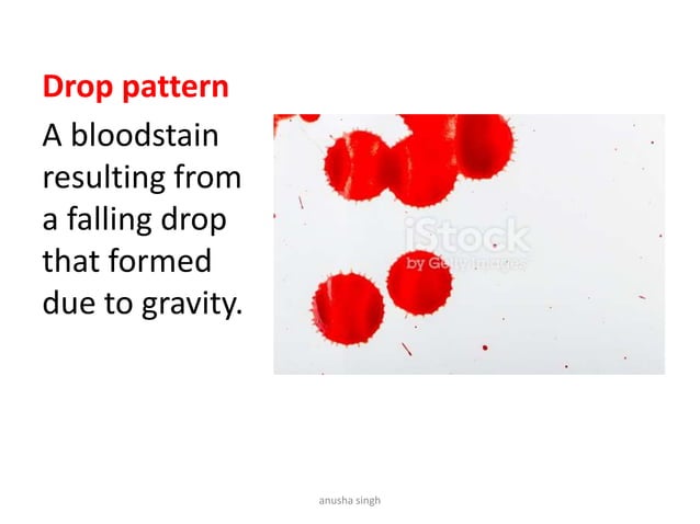 blood spatter analysis | PPT