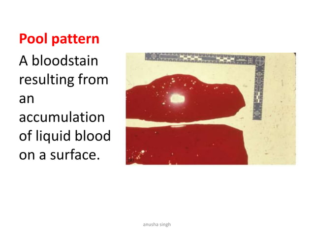blood spatter analysis | PPT