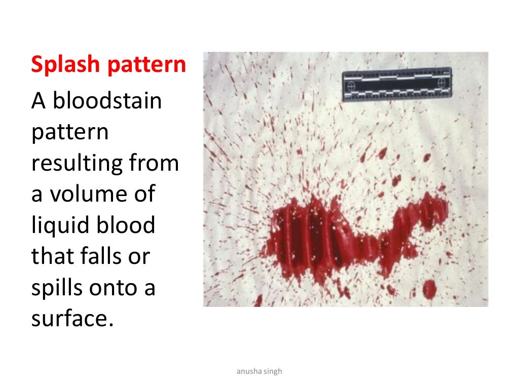 blood spatter analysis