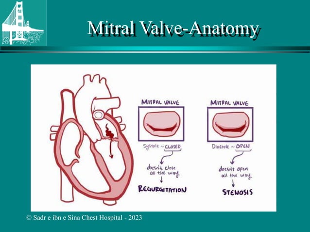 Mitral valve stenosis - AQUIRED HEART DISEASE | PPT