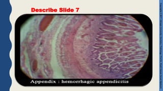 General pathology | PPTX