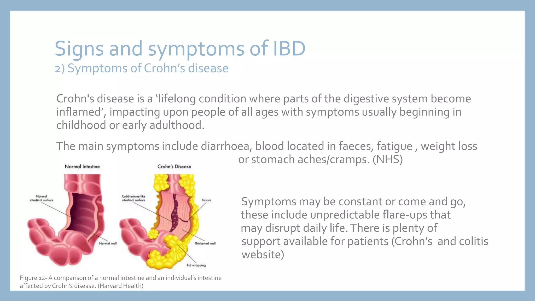 First inflammatory bowel disease presentation finished version (2) | PPT