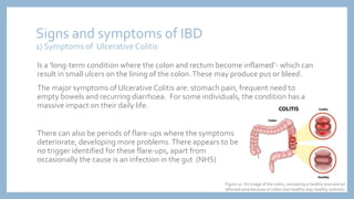 First inflammatory bowel disease presentation finished version (2) | PPT