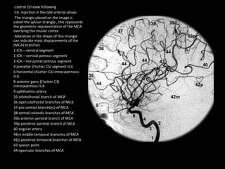 Cerebral Vascular Anatomy and Technique | PPTX | Death, Injury, or ...