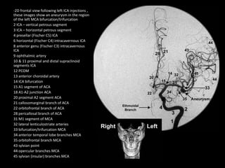Cerebral Vascular Anatomy and Technique | PPTX | Death, Injury, or ...