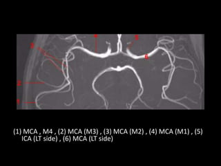 Cerebral Vascular Anatomy and Technique | PPT