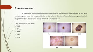 skin cancer detection using machine learning | PPTX