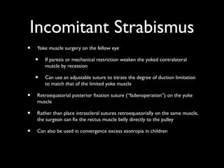 Complicated Adult Strabismus | PPT