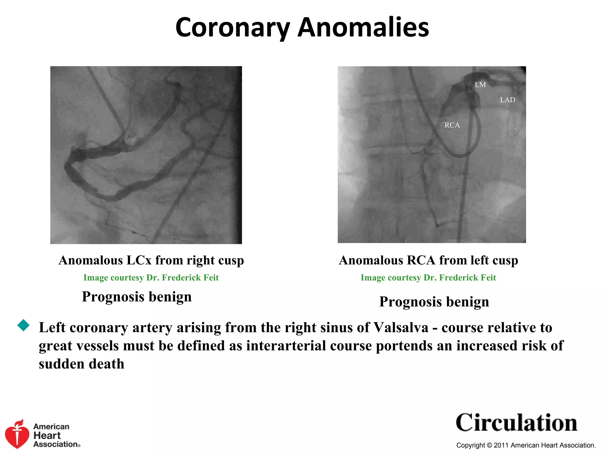First step of coronary angiography | PPT