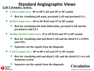 First step of coronary angiography | PPT