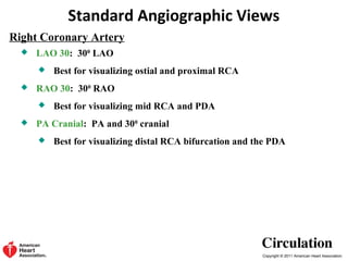 First step of coronary angiography | PPT