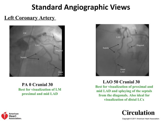 First step of coronary angiography | PPT