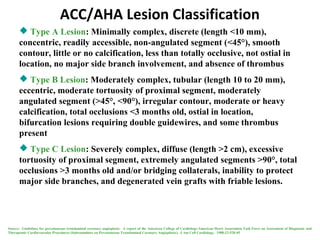 First step of coronary angiography | PPT