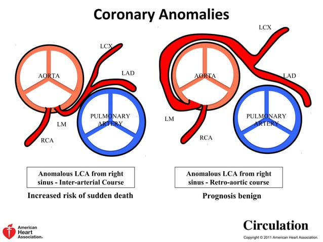 First step of coronary angiography | PPT