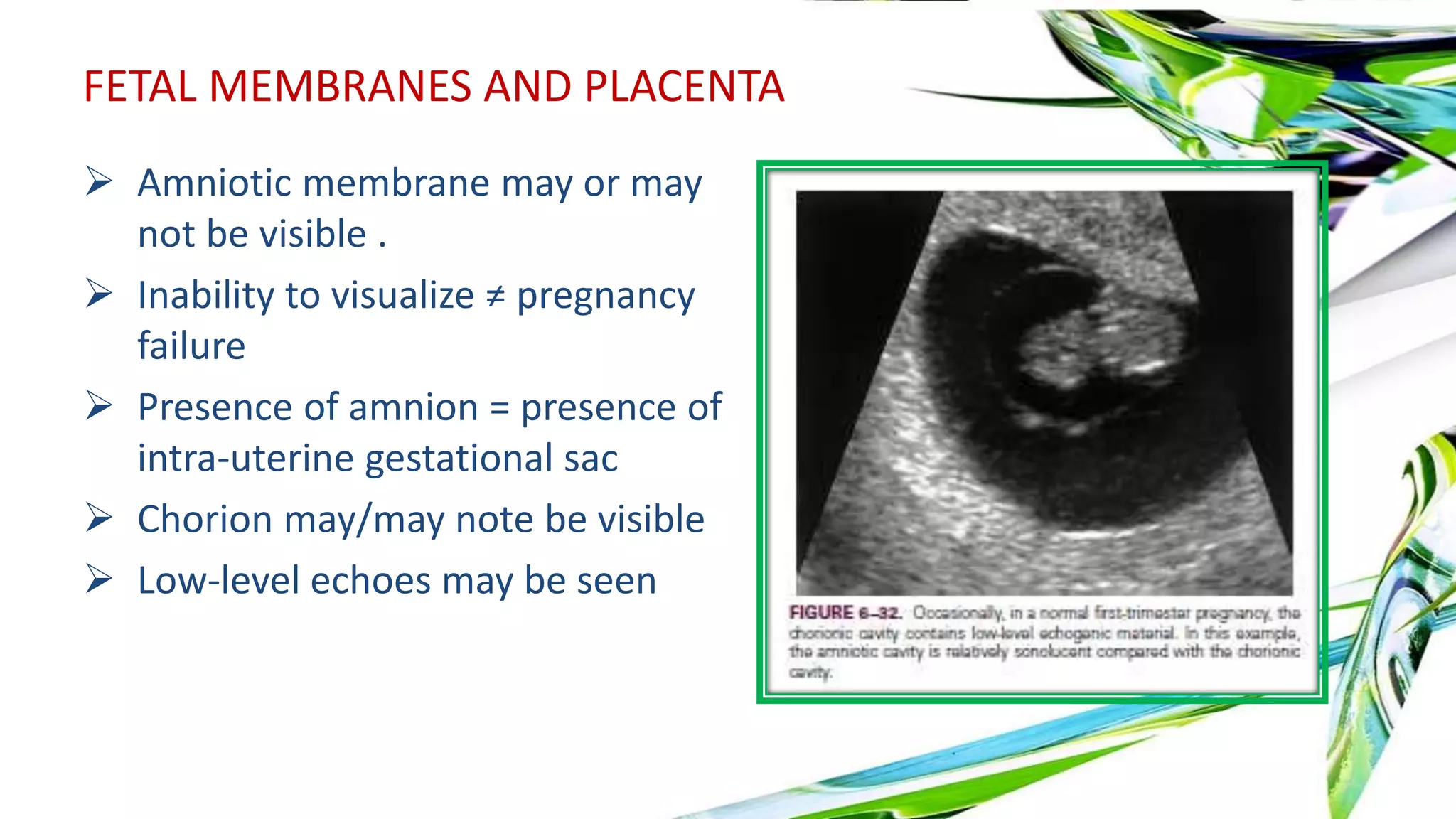First trimester ultrasound | PPTX
