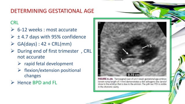 First trimester ultrasound | PPTX