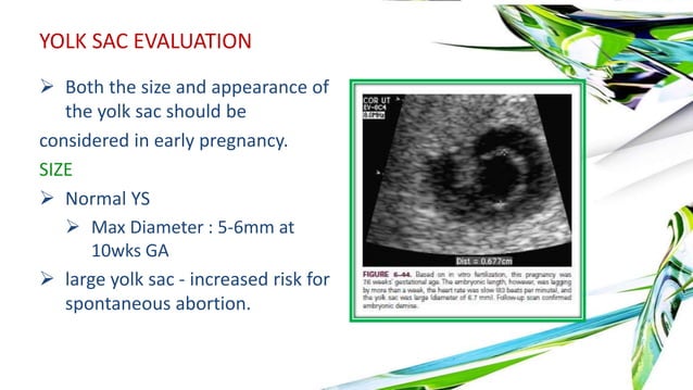 First trimester ultrasound | PPTX