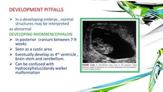 First trimester ultrasound | PPTX