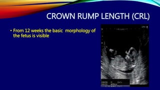 First trimester ultrasound Dr. Muhammad Bin Zulfiqar | PPTX